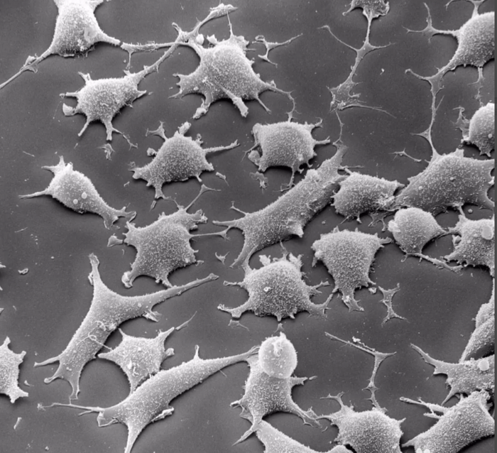 SEM扫描电镜图片怎么分析|铄思百检测